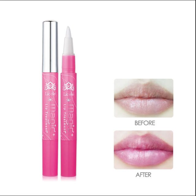 'Magic Lip Treatment' from KOREA, Beauty & Personal Care, Face, Face ...