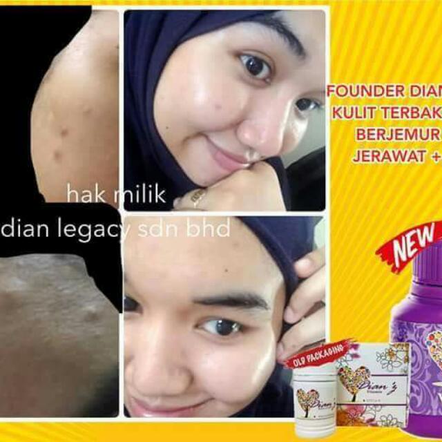 Dianz Vitamin, Beauty & Personal Care, Face, Face Care on Carousell
