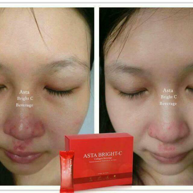 ASTA BRIGHT-C COLLAGEN BEVERAGE, Health & Nutrition, Health Supplements ...