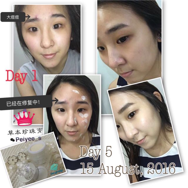 Botanical Pearl Cream, Beauty & Personal Care, Face, Face Care on Carousell