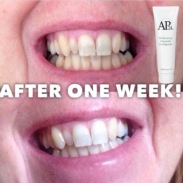 AP24 Whitening Fluoride Toothpaste, Beauty & Personal Care, Face, Face ...