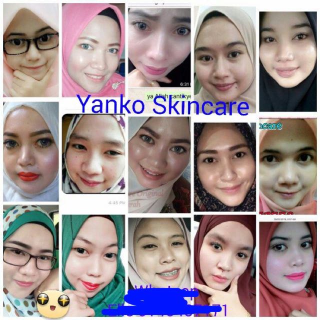 YANKO SKINCARE BASIC SET, Beauty & Personal Care, Face, Face Care on ...