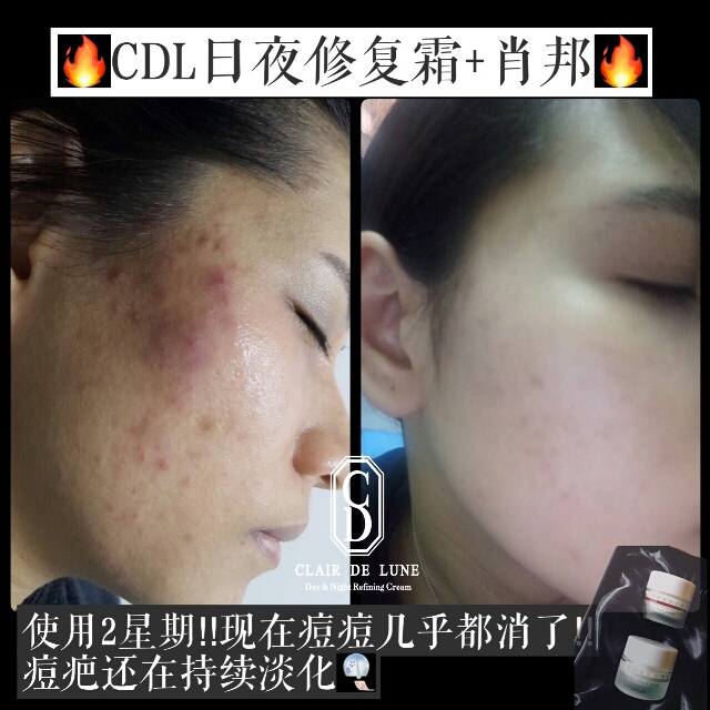 CDL cream, Beauty & Personal Care, Bath & Body, Body Care on Carousell
