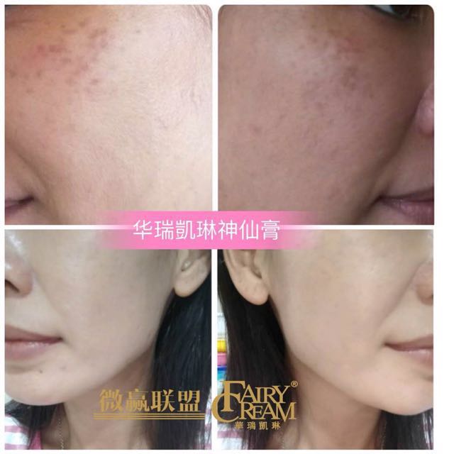 Fairy cream (beauty cream) flawless skin treatment day and night can be ...