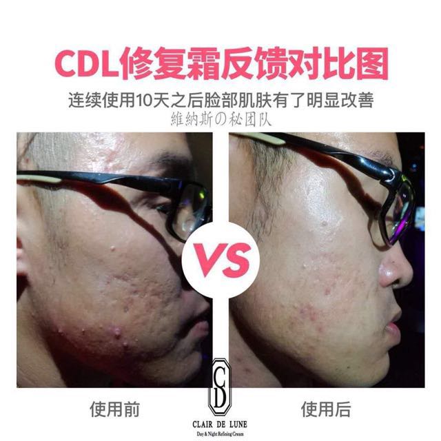 Fairy cream (beauty cream) flawless skin treatment day and night can be ...