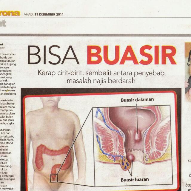 Produk Rawatan Penyakit Buasir, Everything Else, Others on Carousell