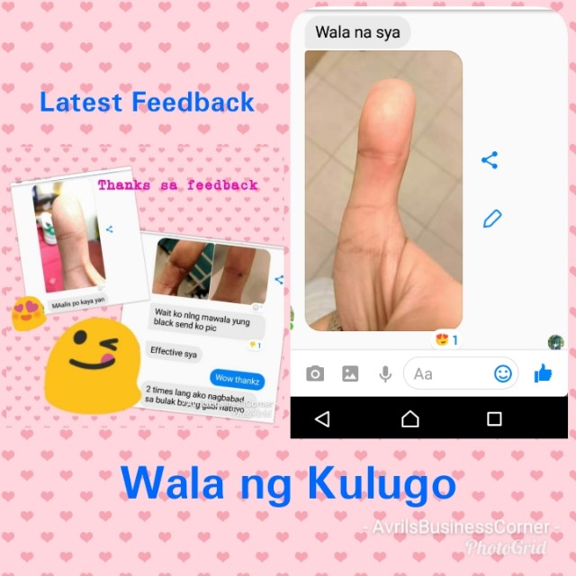 Warts and Kulugo Buster Kasoy Oil on Carousell