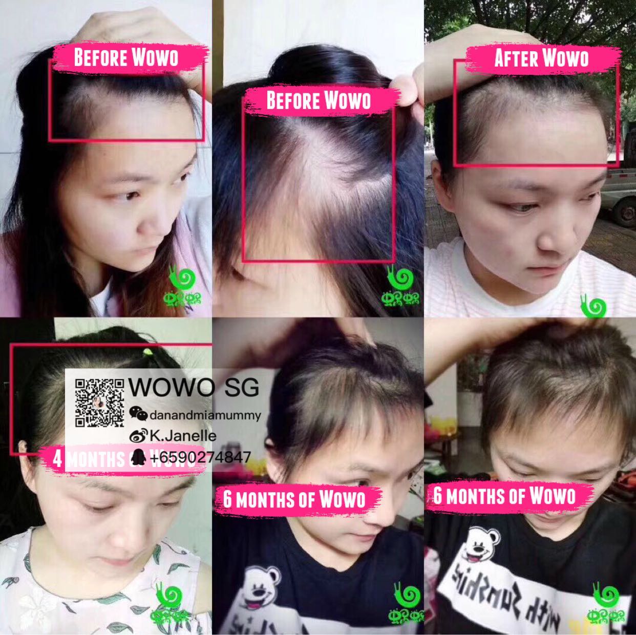 WOWO Hair Care, Beauty & Personal Care, Hair on Carousell