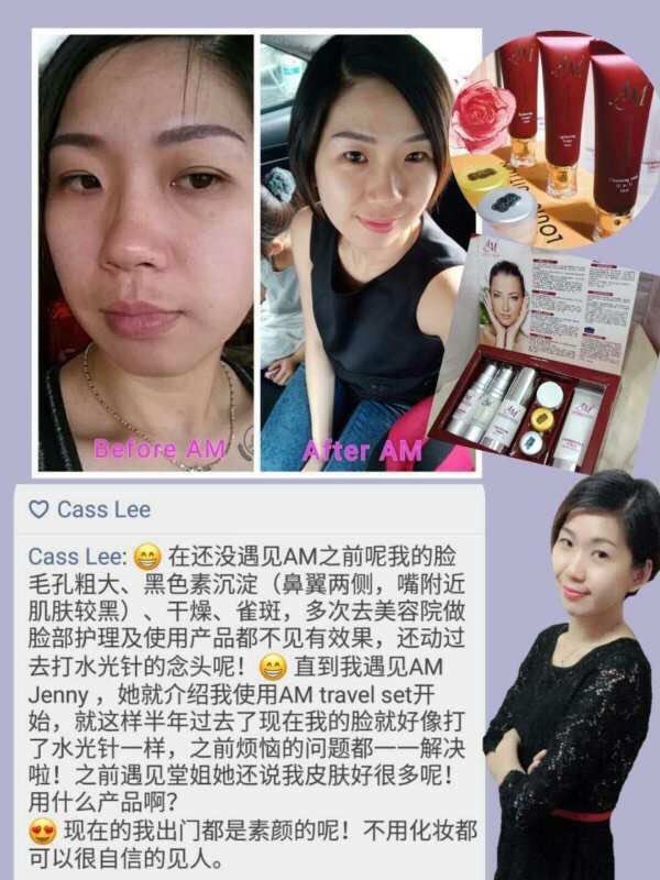 AM PRINCE MIRACLE SET (STARTER KIT), Beauty & Personal Care, Bath ...