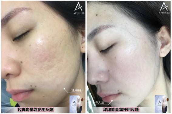 APRIL 22 ROSE ENERGY CREAM - 5 in 1 function!! Safe for pregnant ...