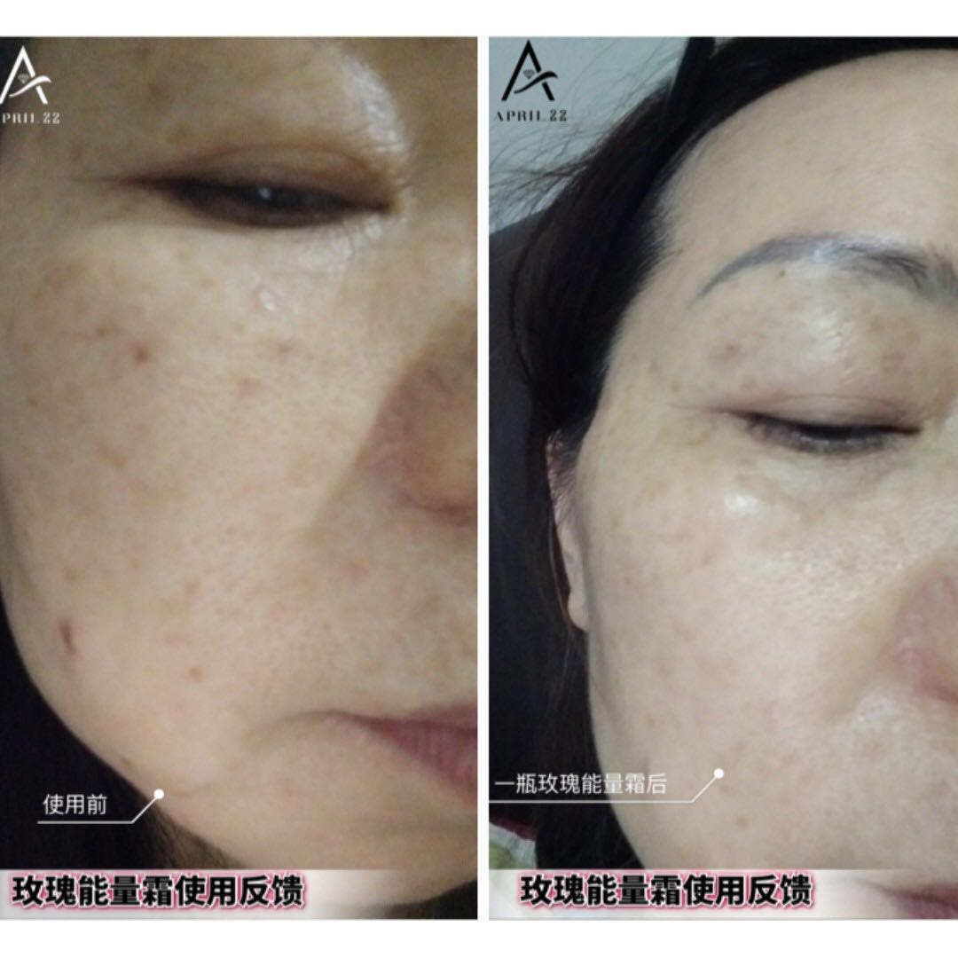 APRIL 22 ROSE ENERGY CREAM - 5 in 1 function!! Safe for pregnant ...