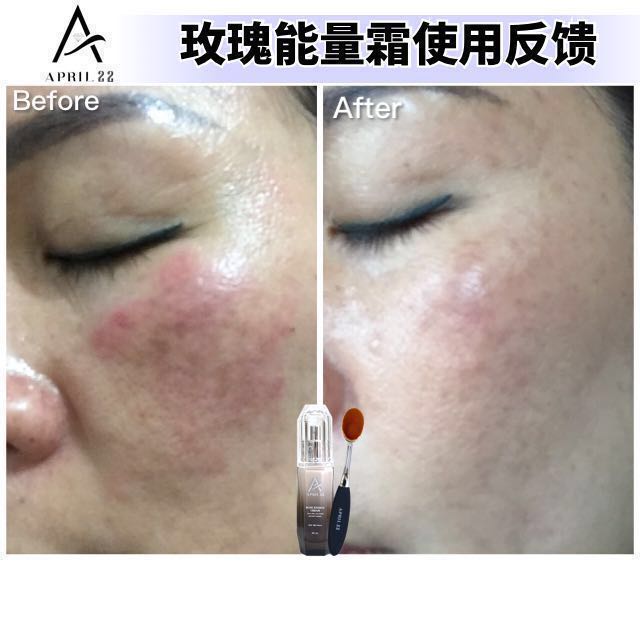 APRIL 22 ROSE ENERGY CREAM - 5 in 1 function!! Safe for pregnant ...