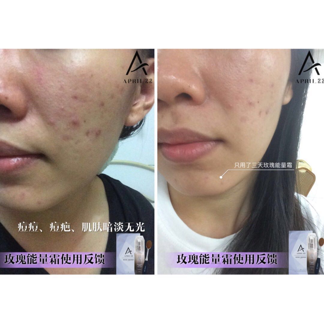 APRIL 22 ROSE ENERGY CREAM - 5 in 1 function!! Safe for pregnant ...