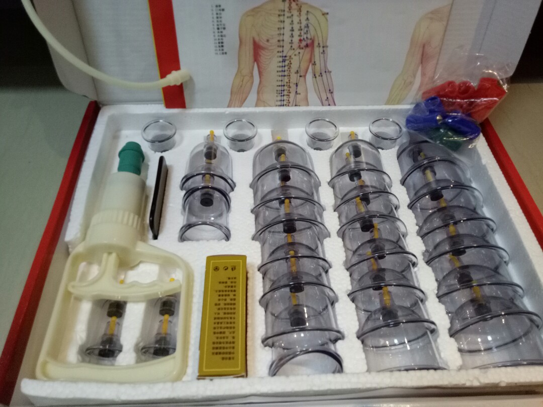 $40 hijama/bekam/cupping, Beauty & Personal Care, Sanitary Hygiene on Carousell