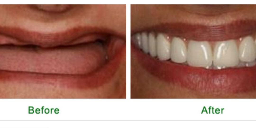 Libre pustiso, Community on Carousell