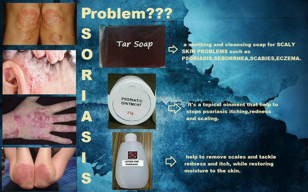 Psoriasis ointment, Beauty & Personal Care, Foot Care on Carousell