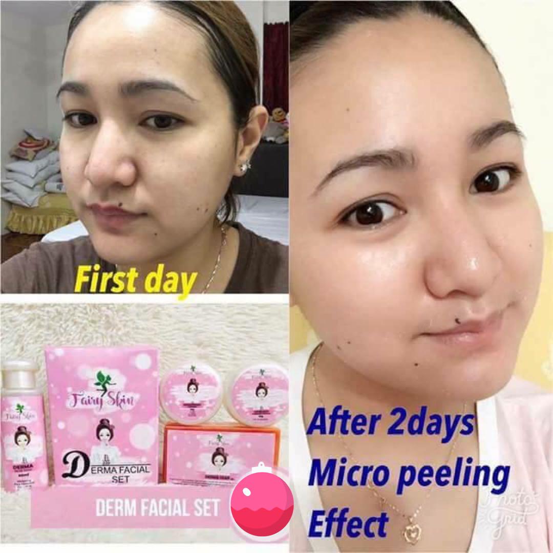 Fairy Skin Derma Facial Set, Beauty & Personal Care, Face, Face Care on ...