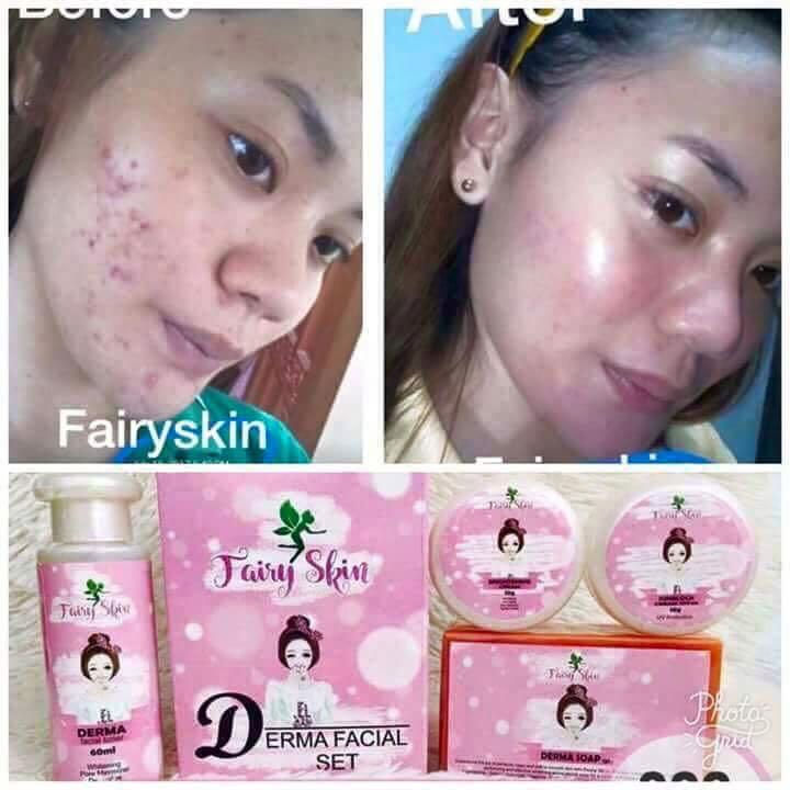 Fairy Skin Derma Facial Set, Beauty & Personal Care, Face, Face Care on Carousell