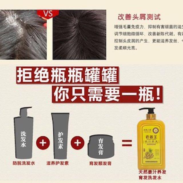 Ginger wang/natural ginger/Scalp Care Shampoo (800ML) / Treat Dandruff ...