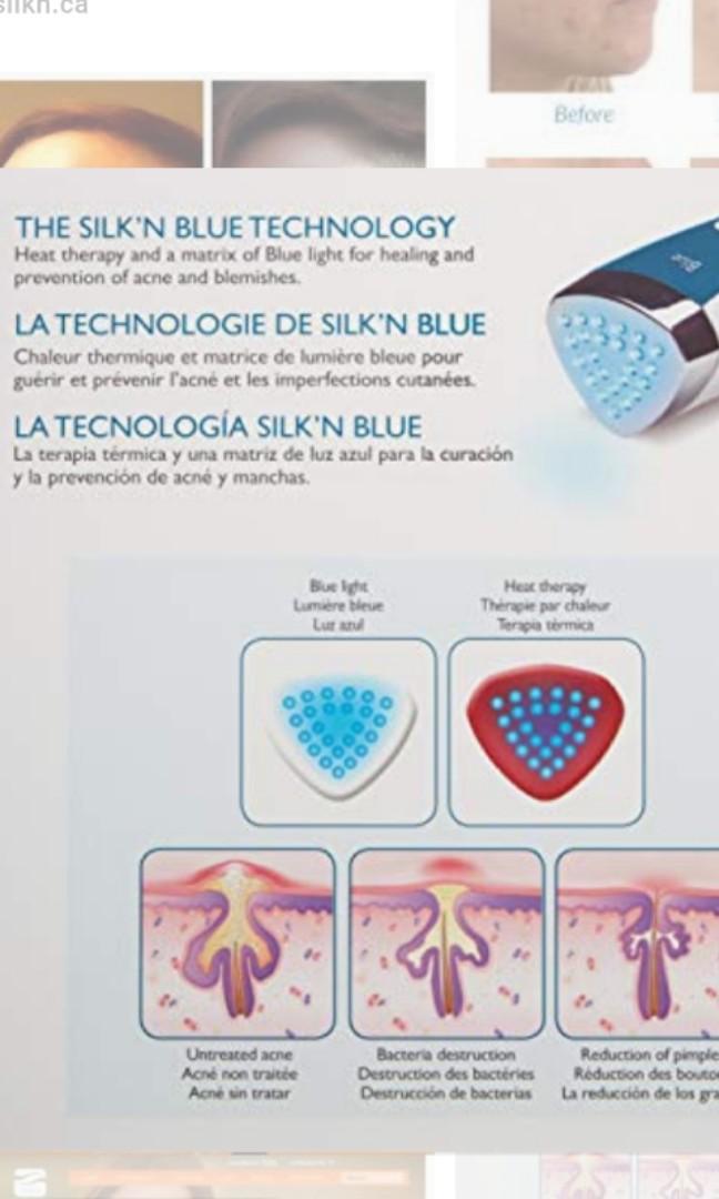 Silk'n Blue light Device for acne treatment, Beauty & Personal Care ...