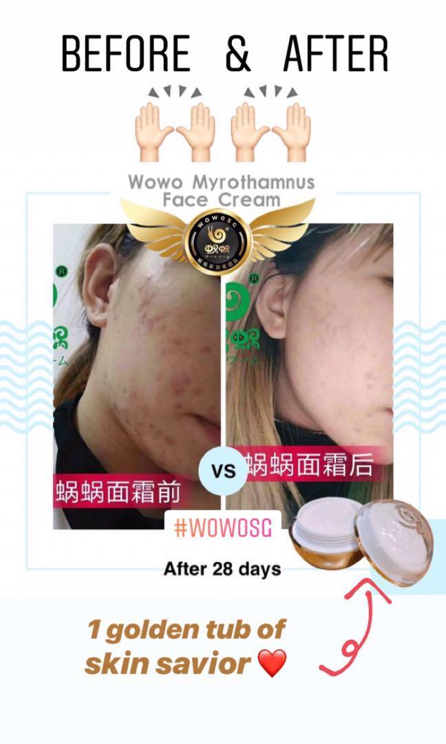 Wowo Myrothamnus Flabellifolia face cream, Beauty & Personal Care, Face ...