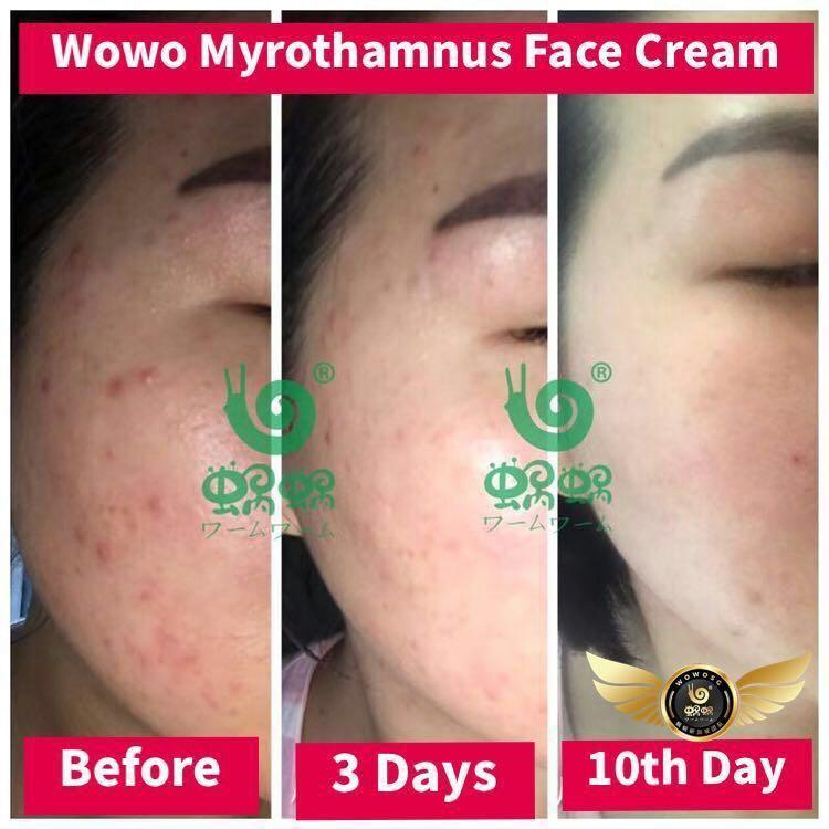 Wowo Myrothamnus Flabellifolia face cream, Beauty & Personal Care, Face ...