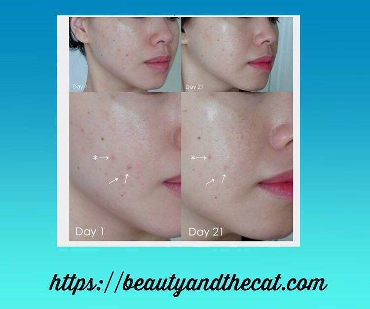 Holy Snail Shark Sauce Serum (7 ml) READY STOCK, Beauty & Personal Care ...