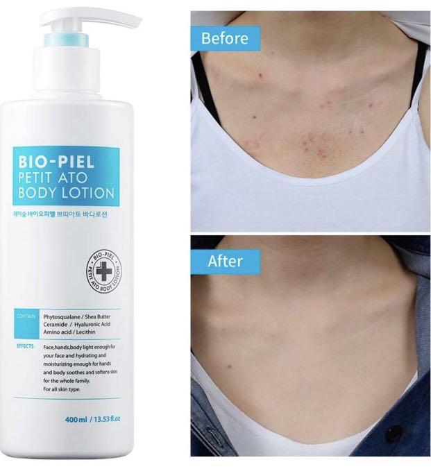 JSOOP Bio-Piel Petit Ato Body Lotion 400ml, Beauty & Personal Care ...