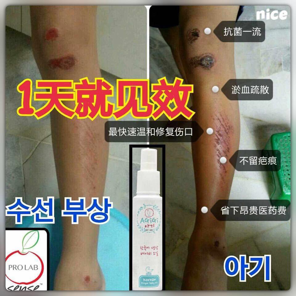 AGiGi Baby Oil Spray from Korean 100ml, Beauty & Personal Care, Bath ...