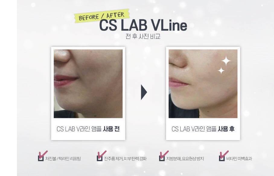 VLine Face Countouring + Glutathione, Beauty & Personal Care, Face ...