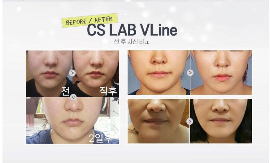 VLine Face Countouring + Glutathione, Beauty & Personal Care, Face ...