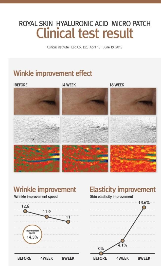 Royal Skin Hyaluronic Acid Micro Patch for eyes, Beauty & Personal Care ...