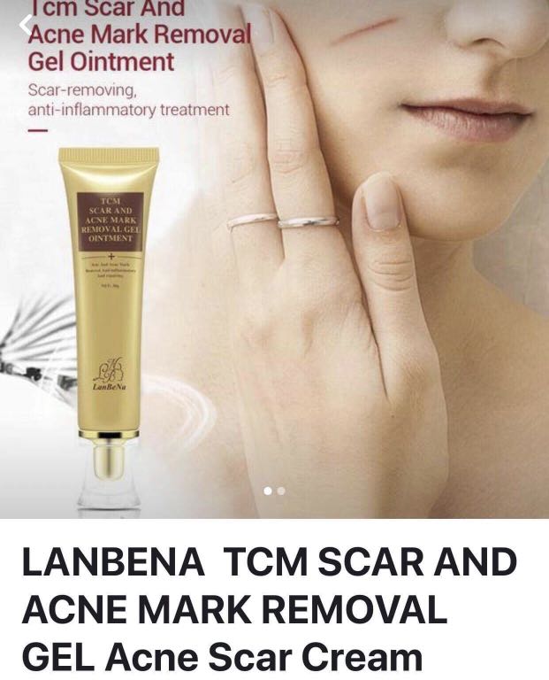 Original TCM SCAR and Acne Removal, Beauty & Personal Care, Face, Face ...