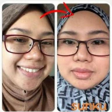 Suriku collagen on Carousell