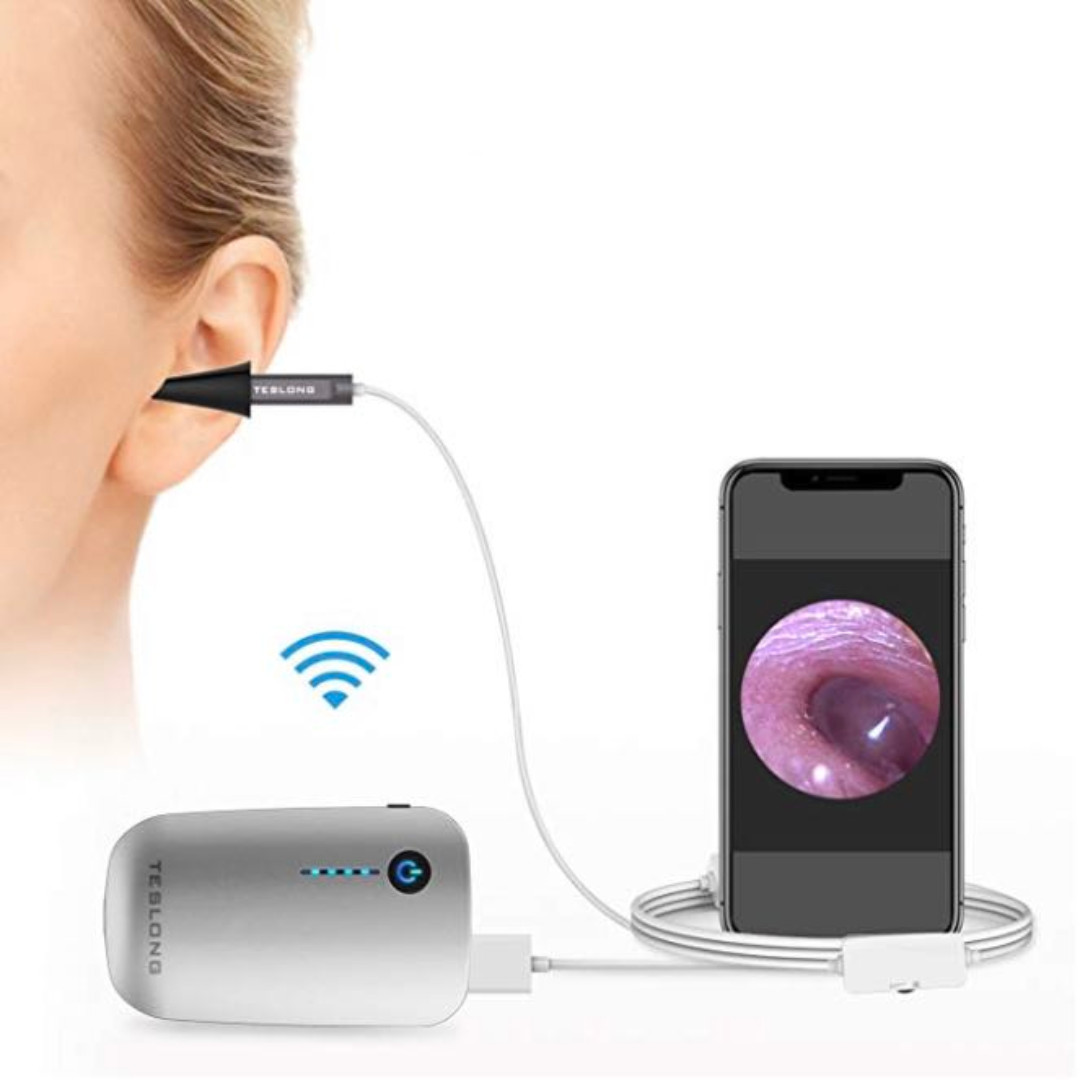 (E1673) Teslong Wireless Otoscope, WiFi Ear Scope Ear Canal Eardrum ...