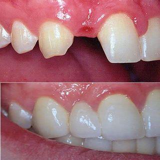 pustiso - View all pustiso ads in Carousell Philippines