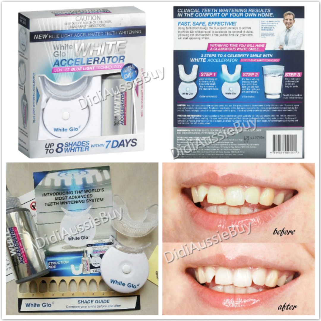 White Glo Accelerator Blue Light Teeth Whitening System Reviews ...