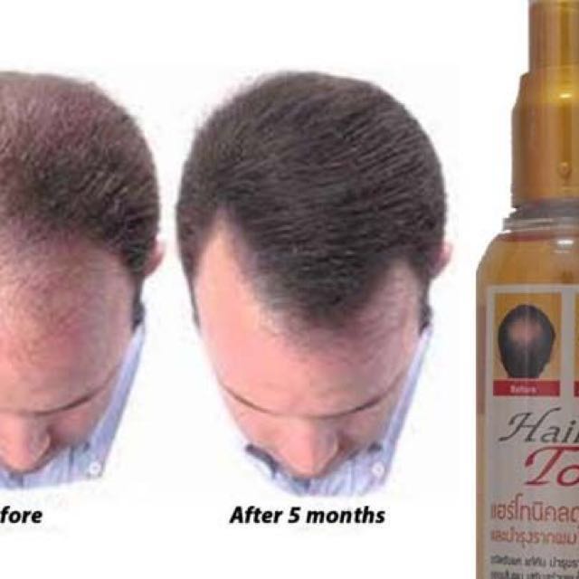 Ganive Hair Growth Tonic Protect Hair loss, Beauty & Personal Care ...