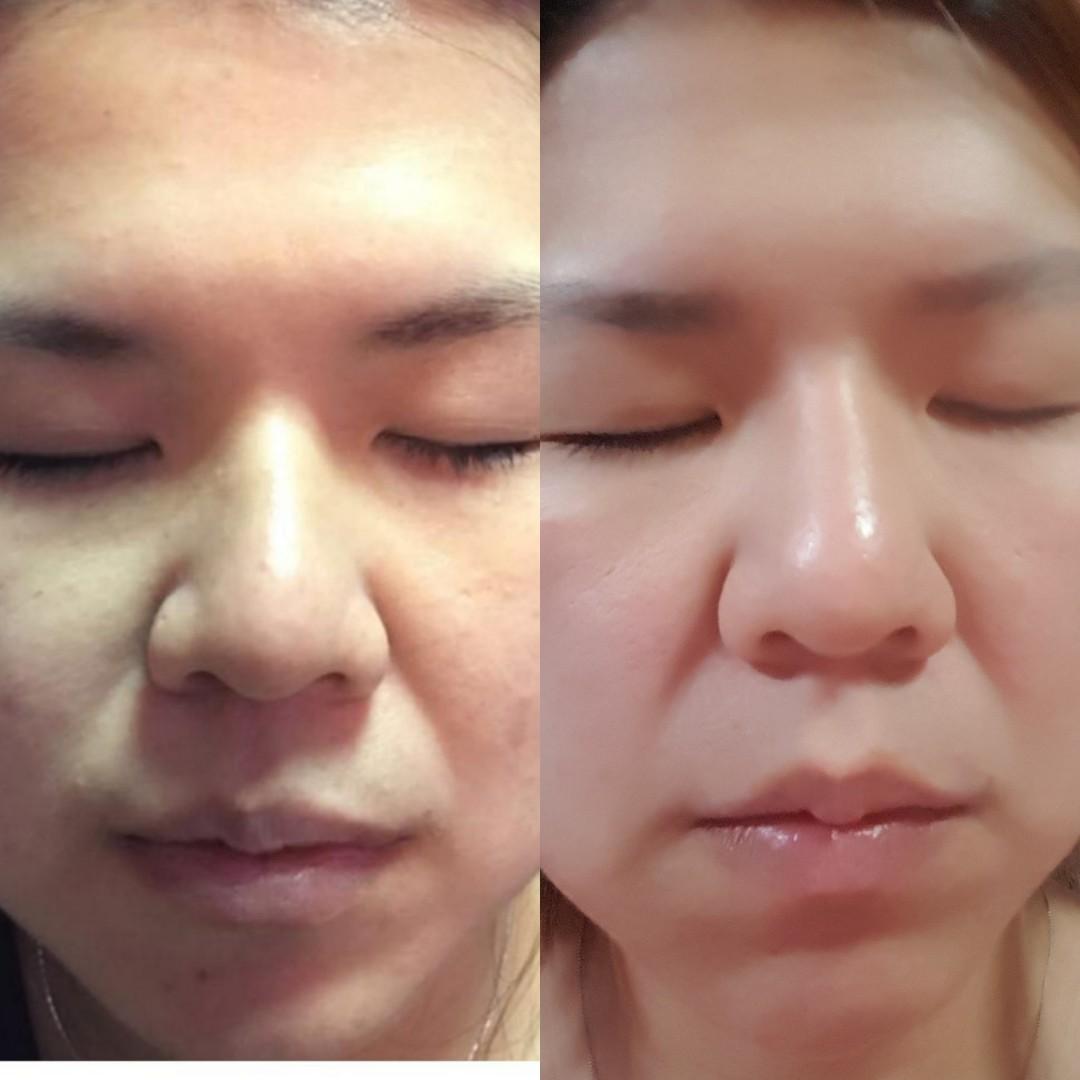 Easy dew, Beauty & Personal Care, Face, Face Care on Carousell