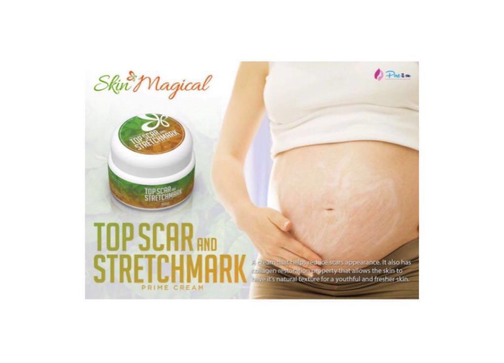 Top Scar and Stretchmark Prime Cream, Health & Nutrition, Medical ...