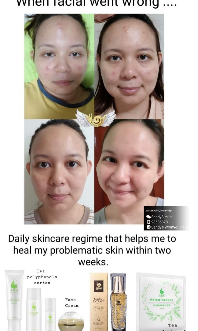 Authentic Wowo WouWou Skin Care, Beauty & Personal Care, Face, Face ...