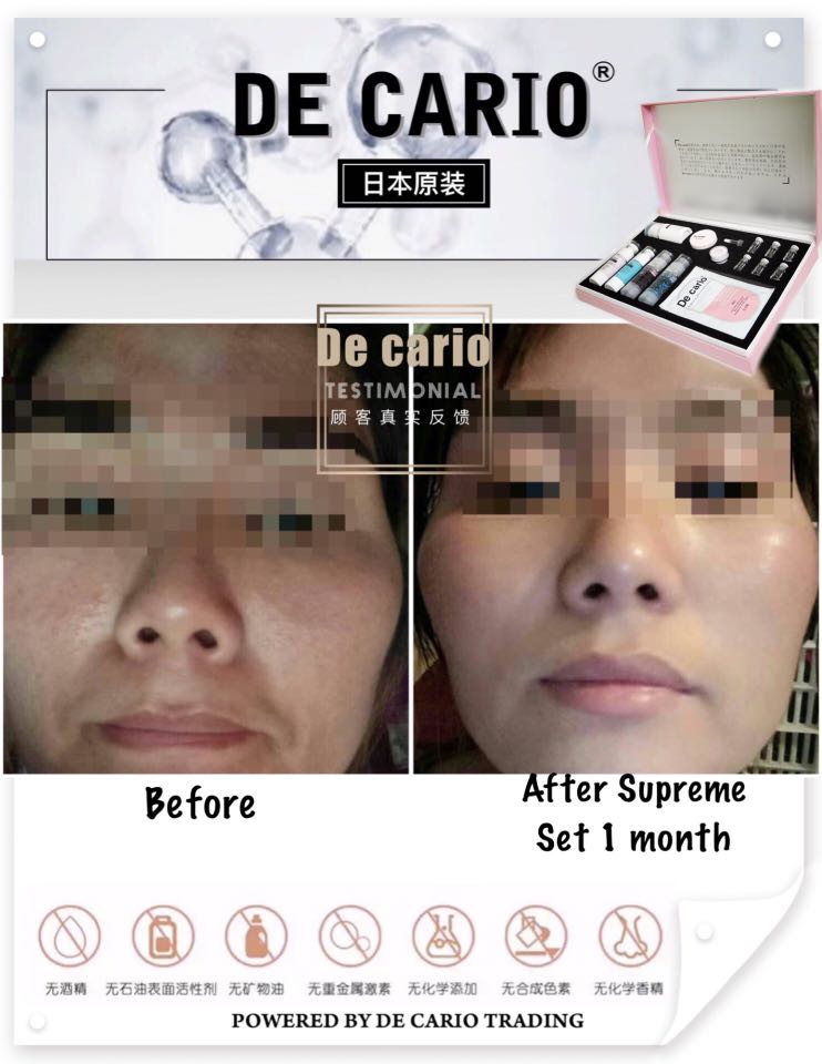 Japan Skincare - De Cario Supreme Set, Beauty & Personal Care, Face ...