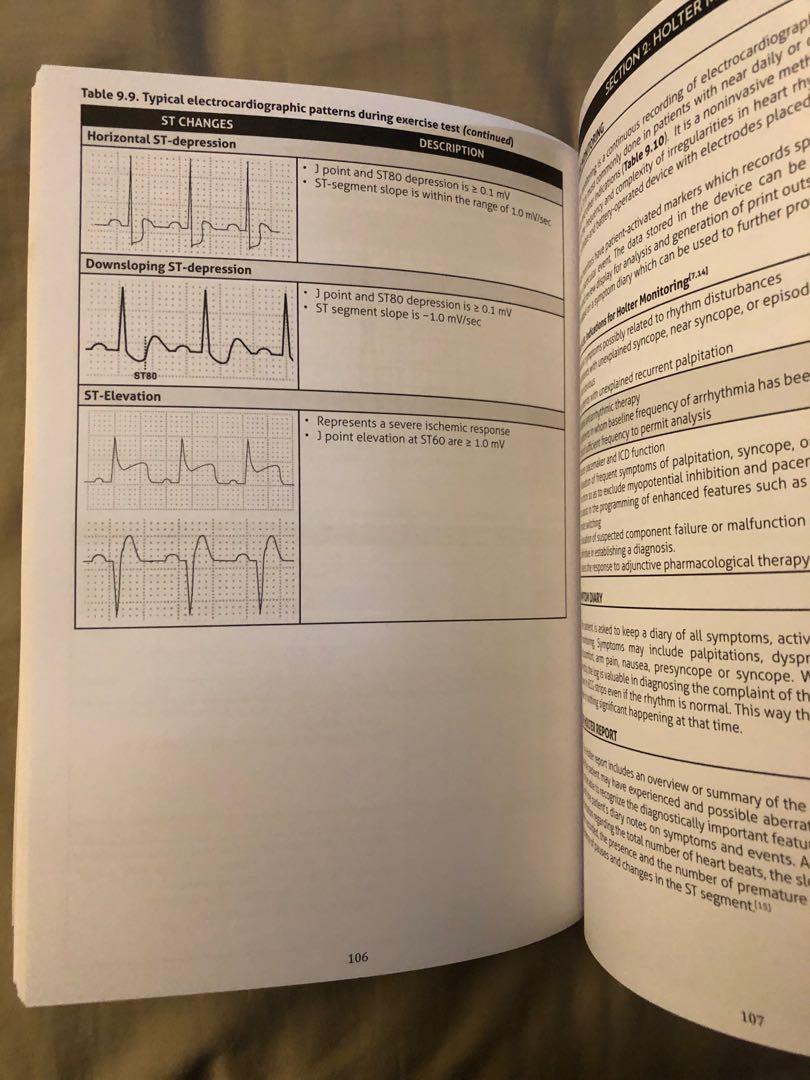 My First ECG Handbook, Hobbies & Toys, Books & Magazines, Assessment ...