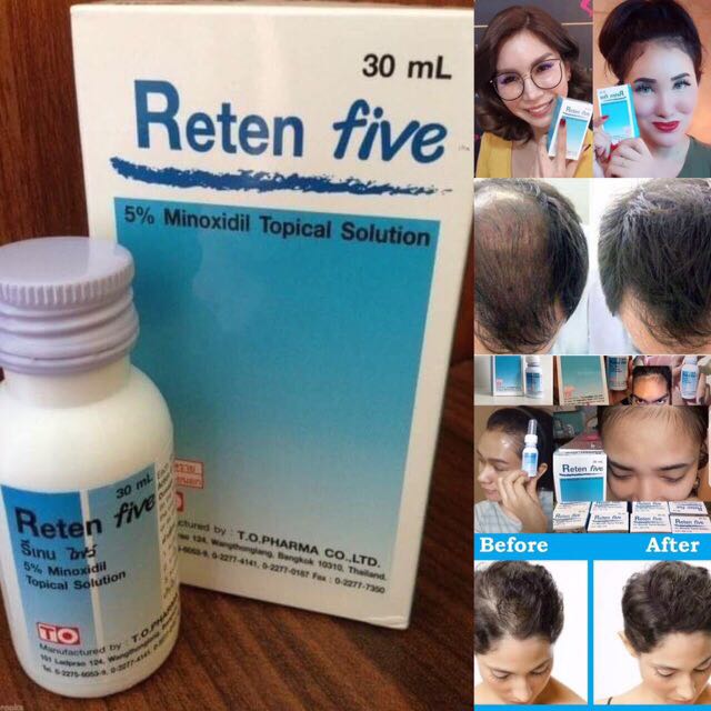 Reten five (tonic rambut), Beauty & Personal Care, Hair on Carousell