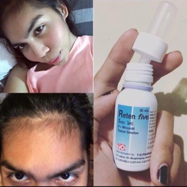 Reten five (tonic rambut), Beauty & Personal Care, Hair on Carousell