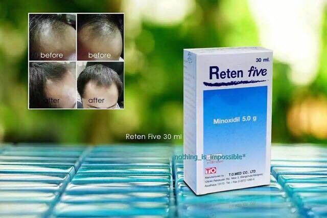 Reten five (tonic rambut), Beauty & Personal Care, Hair on Carousell