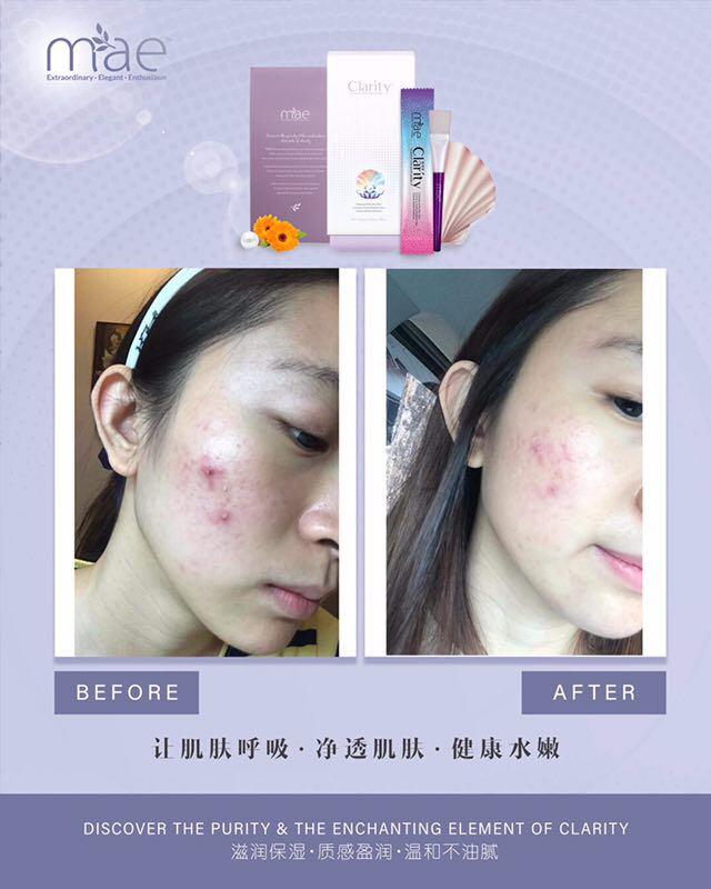 Mae clarity mask, Health & Nutrition, Face Masks & Face Shields on ...