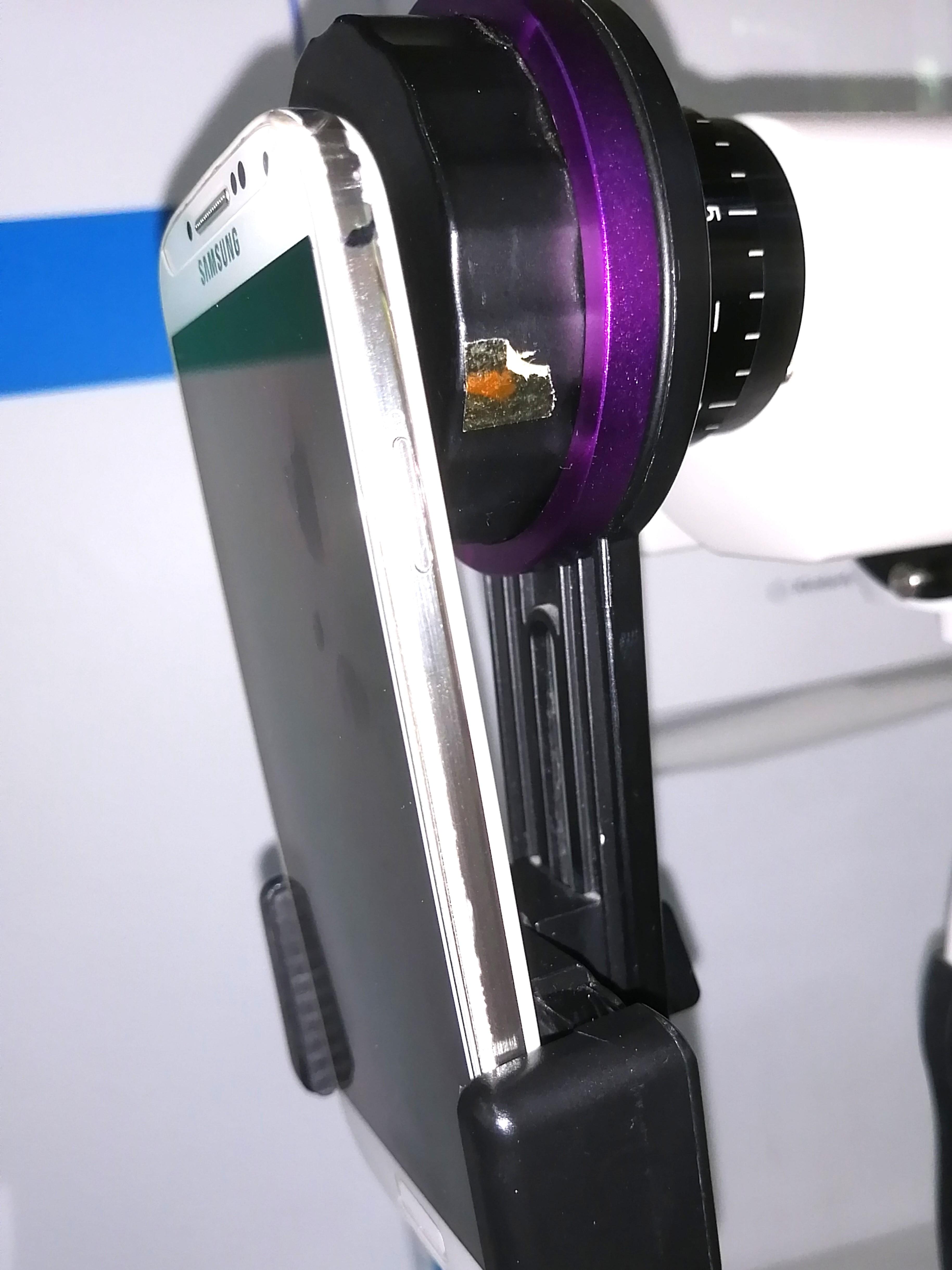 Slit lamp camera holder attachment universal Optometry Ophthalmology ...