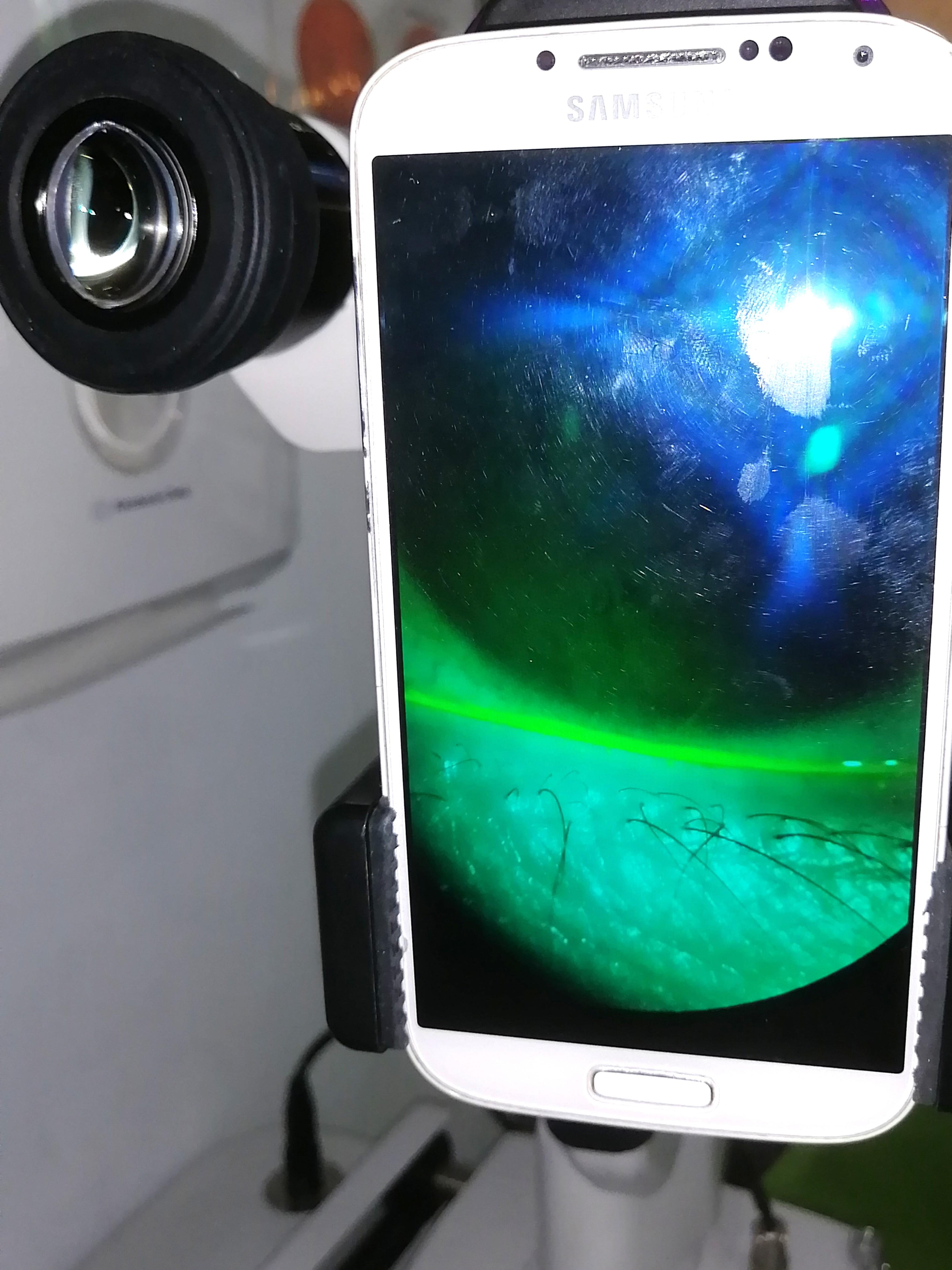 Slit lamp camera holder attachment universal Optometry Ophthalmology ...