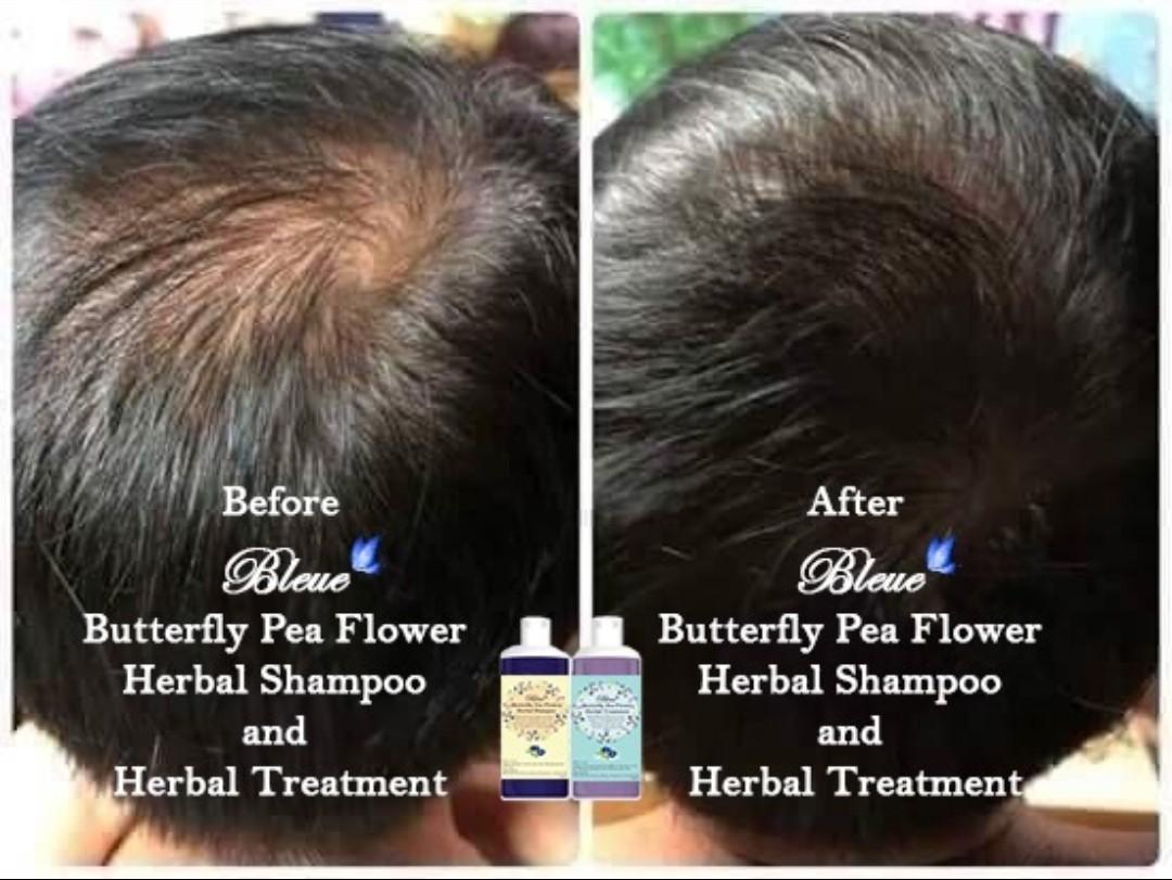 Blue Pea Flower Hair Dye | Best Flower Site